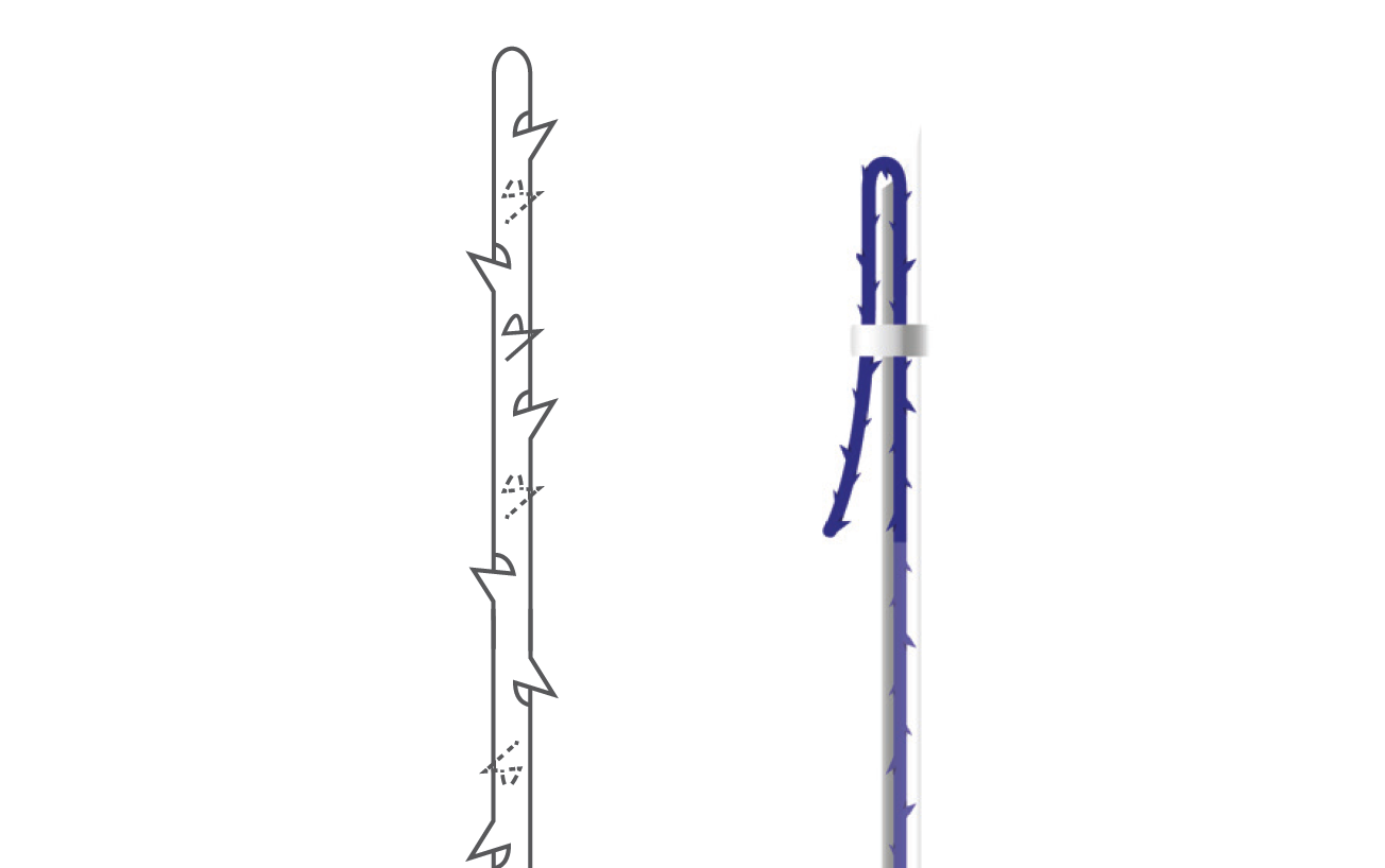 Glam Lifting Thread PDO Combi Cog 23G 38mm - Buy Online | Glam Derma